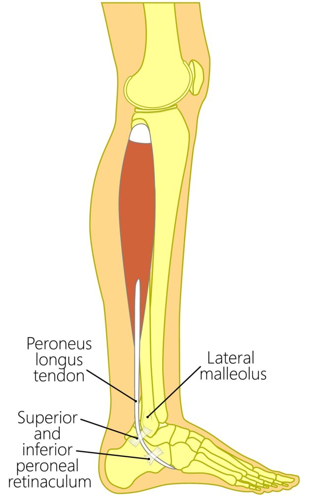 Fibularis (Peroneus) Longus Tendonitis: [Best Treatment for Tendon Pain!]