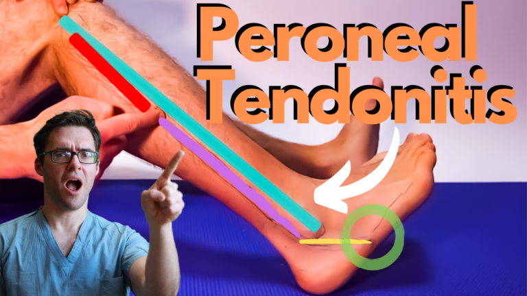Peroneal Tendonitis Treatment [Tendon Pain, Stretches, Exercises]