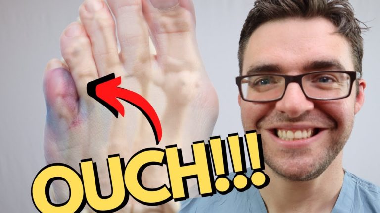 Sprained Pinky Toe or Broken Pinky Toe? [Diagnosis & Best Treatment!]