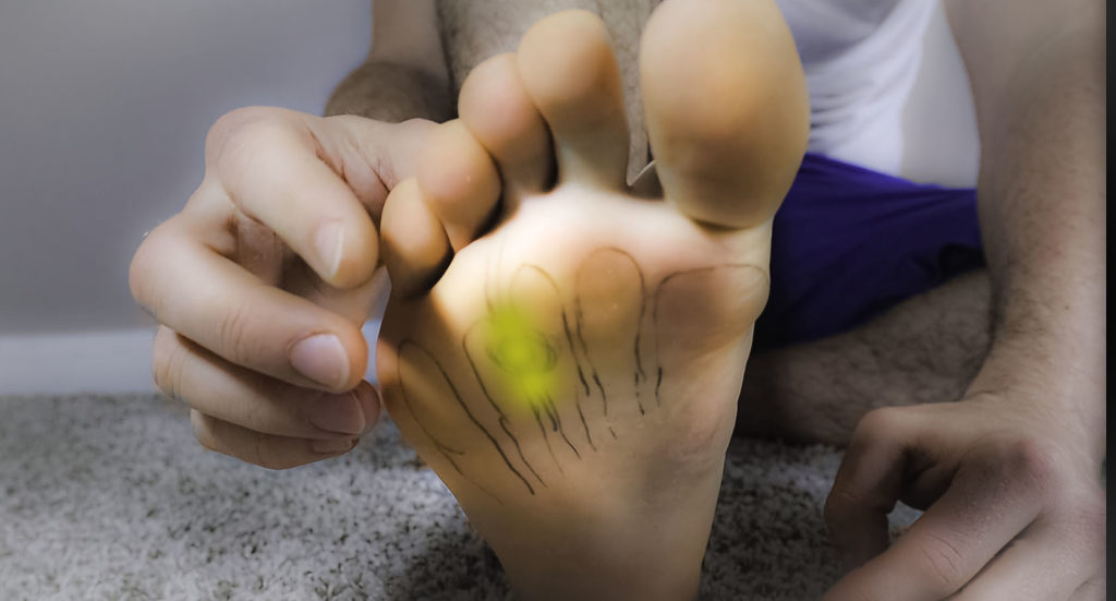 Mulder's Click Test [Morton's Neuroma Squeeze Test & TREATMENT]