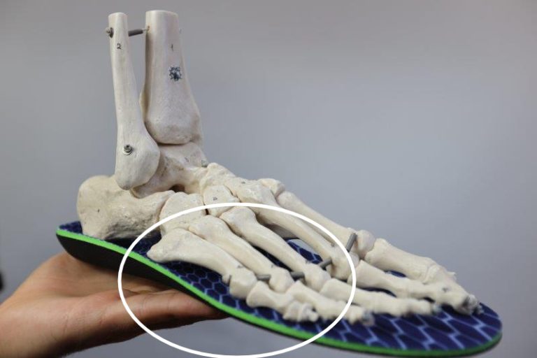 Protruding Bone Outside of Foot 2026 Causes | Podiatrist