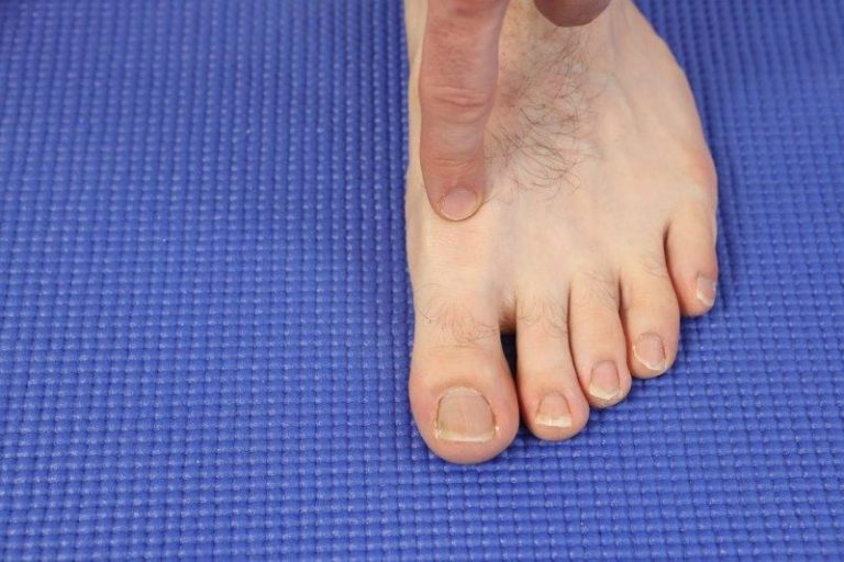 Turf Toe Injury: 5 Best Treatment - Brace, Splint & Recovery