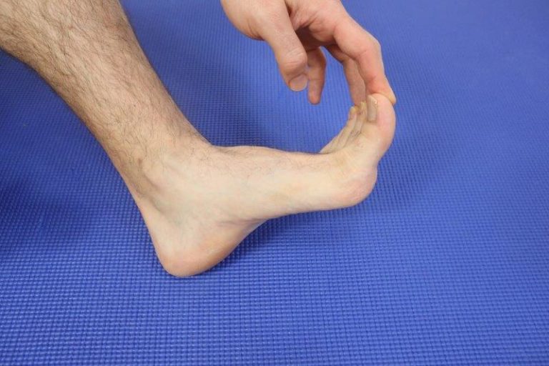 Turf Toe Injury: 5 Best Treatment - Brace, Splint & Recovery