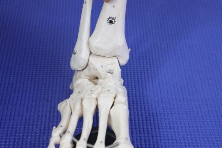 Sprained Big Toe Tendon Pain [Causes, Symptoms & Best Treatment]