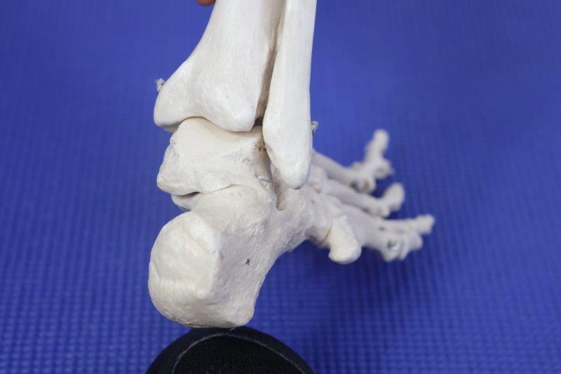 High Ankle Sprain Recovery Time: #1 Best Treatment Guide!