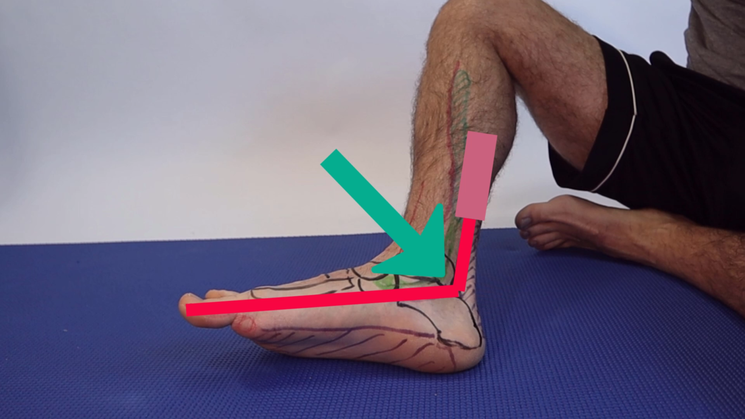 Flexor Hallucis Longus PAIN - 3 FHL Causes & BEST Treatment