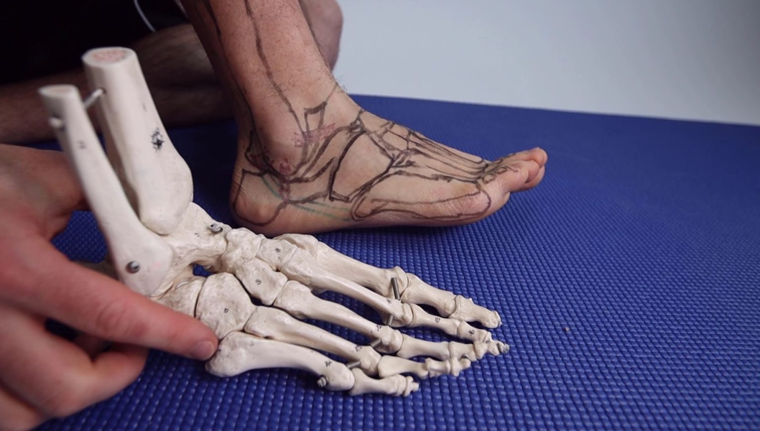 Cuboid Syndrome Treatment | Foot Pain Relief by Podiatrists