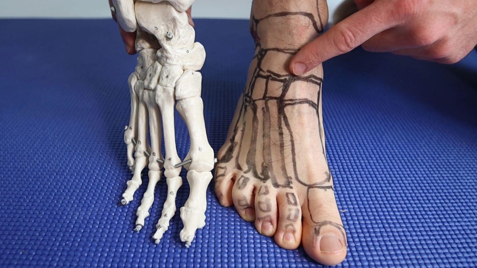 Midtarsal Joint Sprain - The Complete Treatment Guide