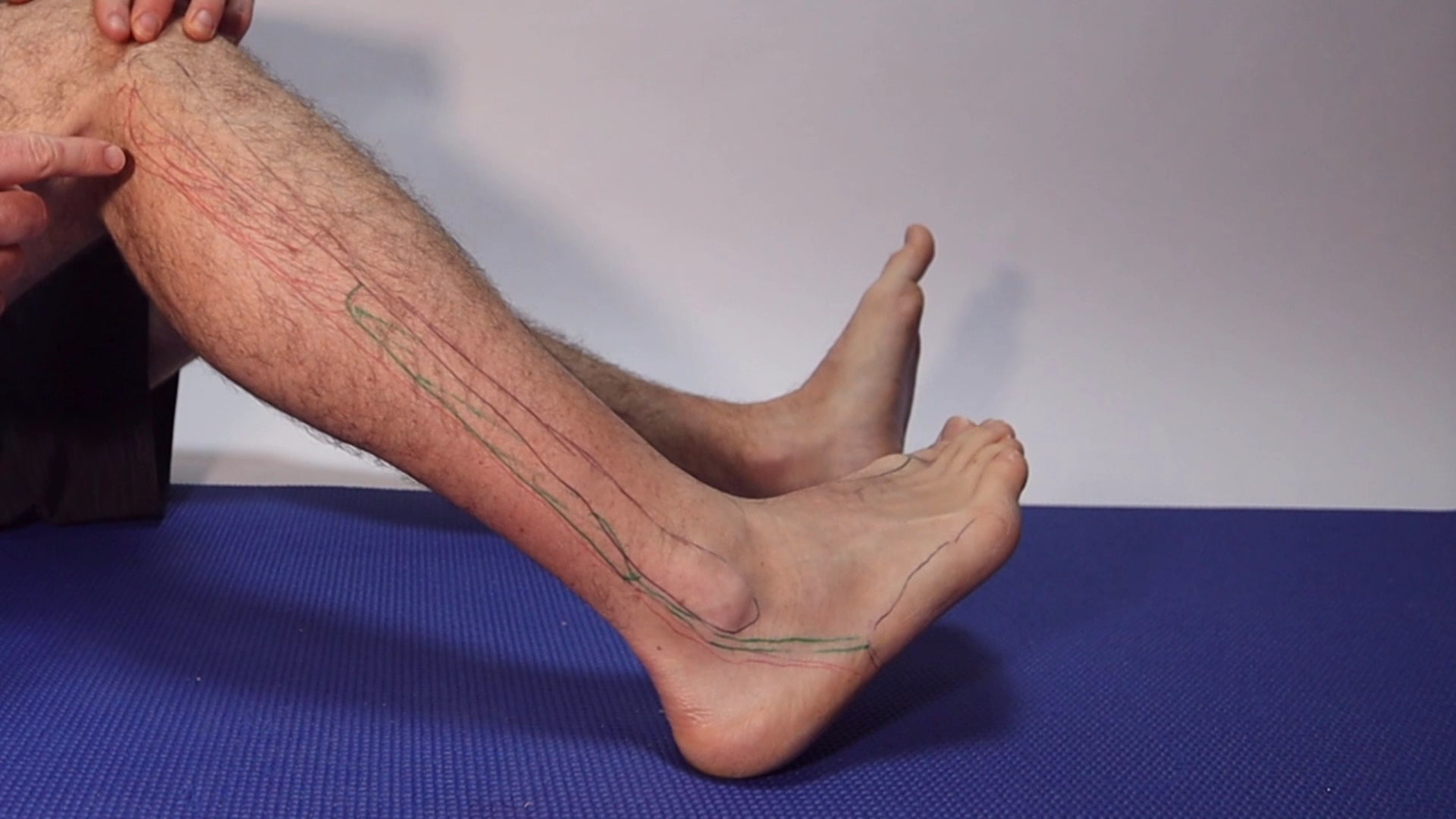 Peroneal tendons - Balance Foot & Ankle Specialists