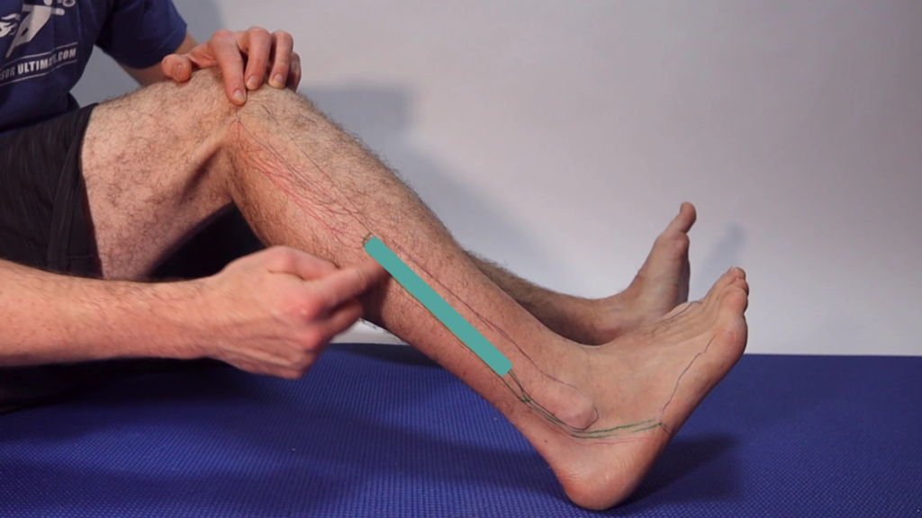 Peroneal Tendonitis Treatment 2020 [Peroneus Brevis & Longus Pain!]