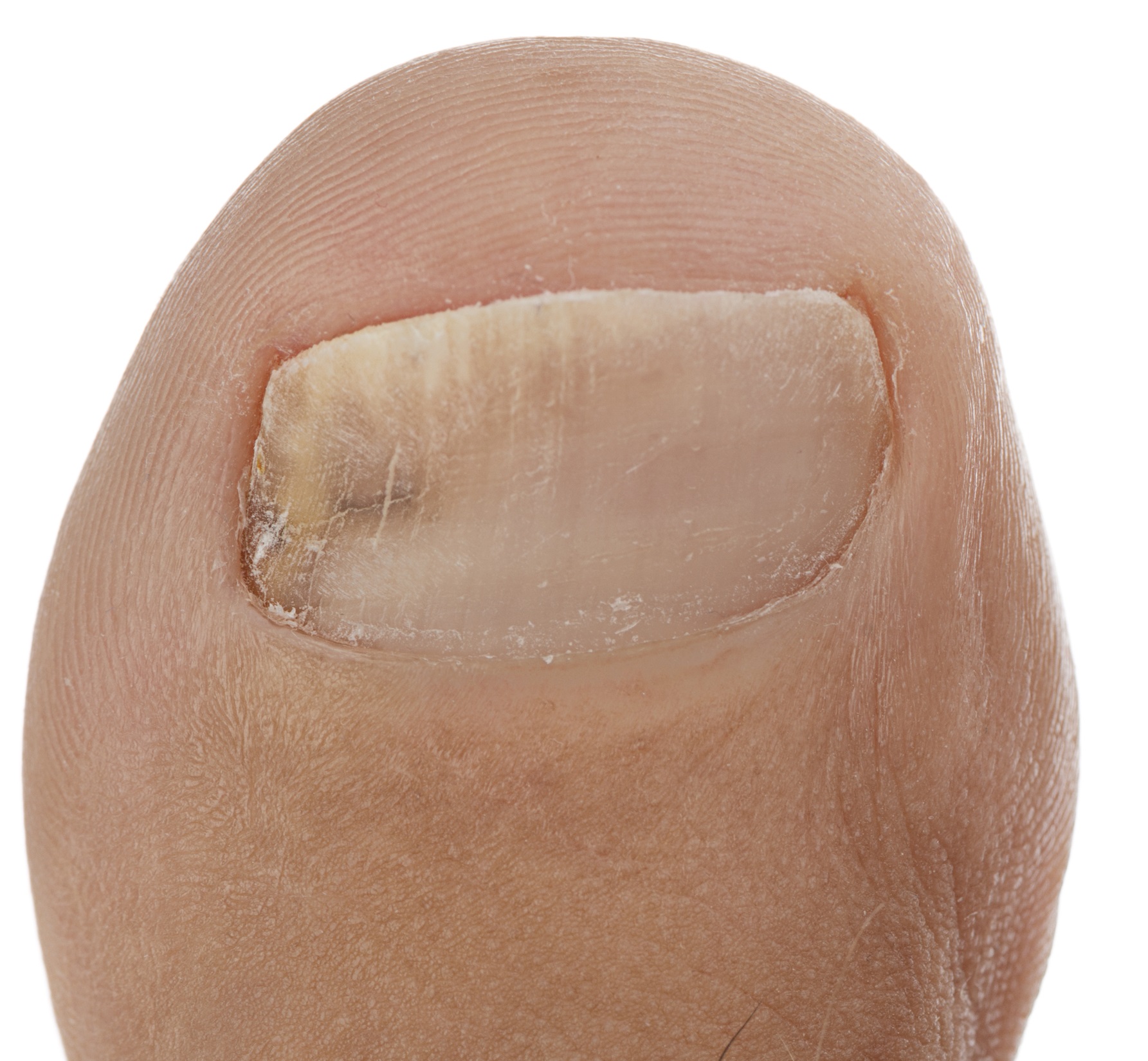 less bad #5 - Balance Foot & Ankle Specialists