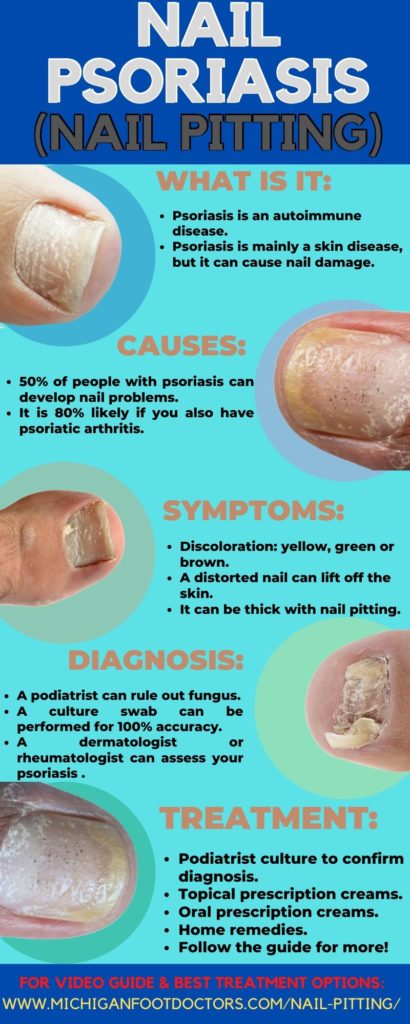 Psoriasis Under The Toenails Nail Pits Causes And Best Treatment