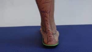 Top 7 Signs of Overpronation – Balance Foot & Ankle